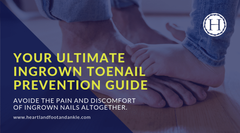 Your Ultimate Ingrown Toenail Prevention Guide - Heartland Foot & Ankle