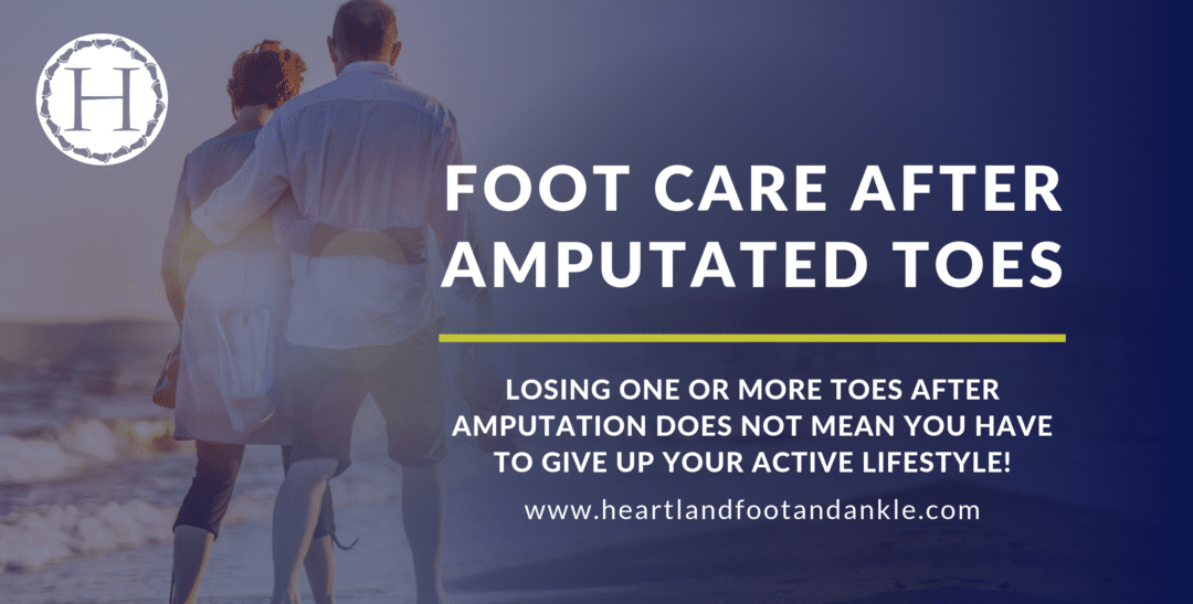 Foot Care After Amputated Toes - Heartland Foot & Ankle