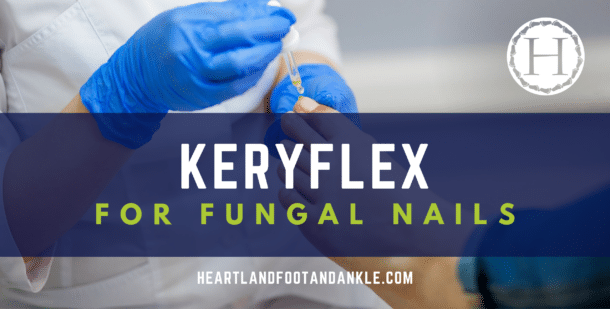KeryFlex for Fungal Nails - Heartland Foot & Ankle